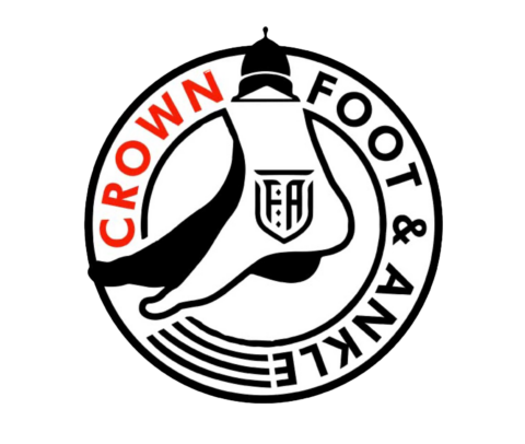 Onyfix Ingrown Toenail Treatment | Crown Foot & Ankle