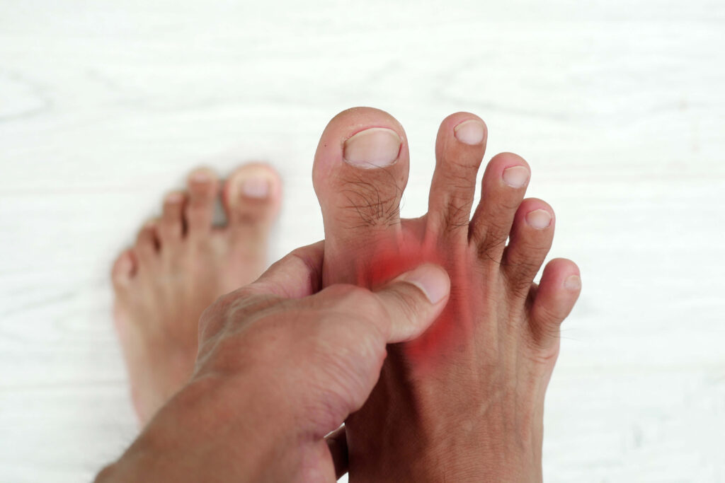 Turf Toe | Crown Foot & Ankle